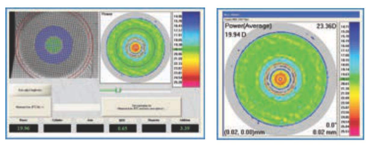 Supra Phob Infocus - Appasamy Hydrophobic Acrylic Lens/ Surgical IOL